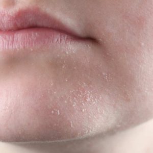 Understanding Your Skin Type